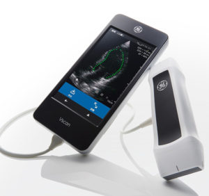 Vscan Extend R2 超音波診断装置 GE の最安値販売！見積り無料の物療機器販売本舗