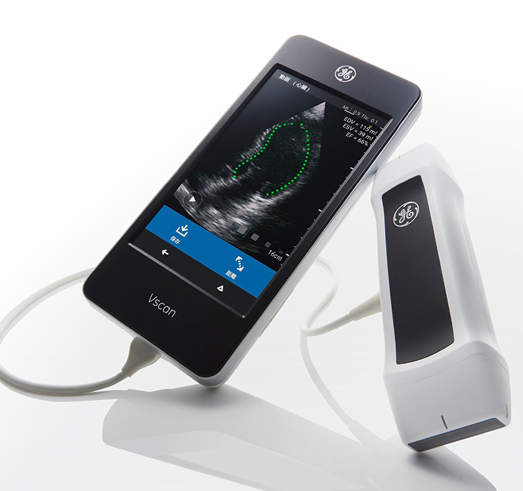 Vscan Extend R2 超音波診断装置 GE の最安値販売！見積り無料の物療機器販売本舗