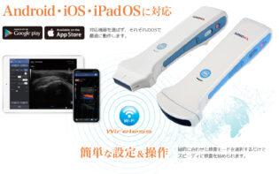 超音波画像診断装置SONON300L ソノン300L の最安値販売！見積り無料の物療機器販売本舗